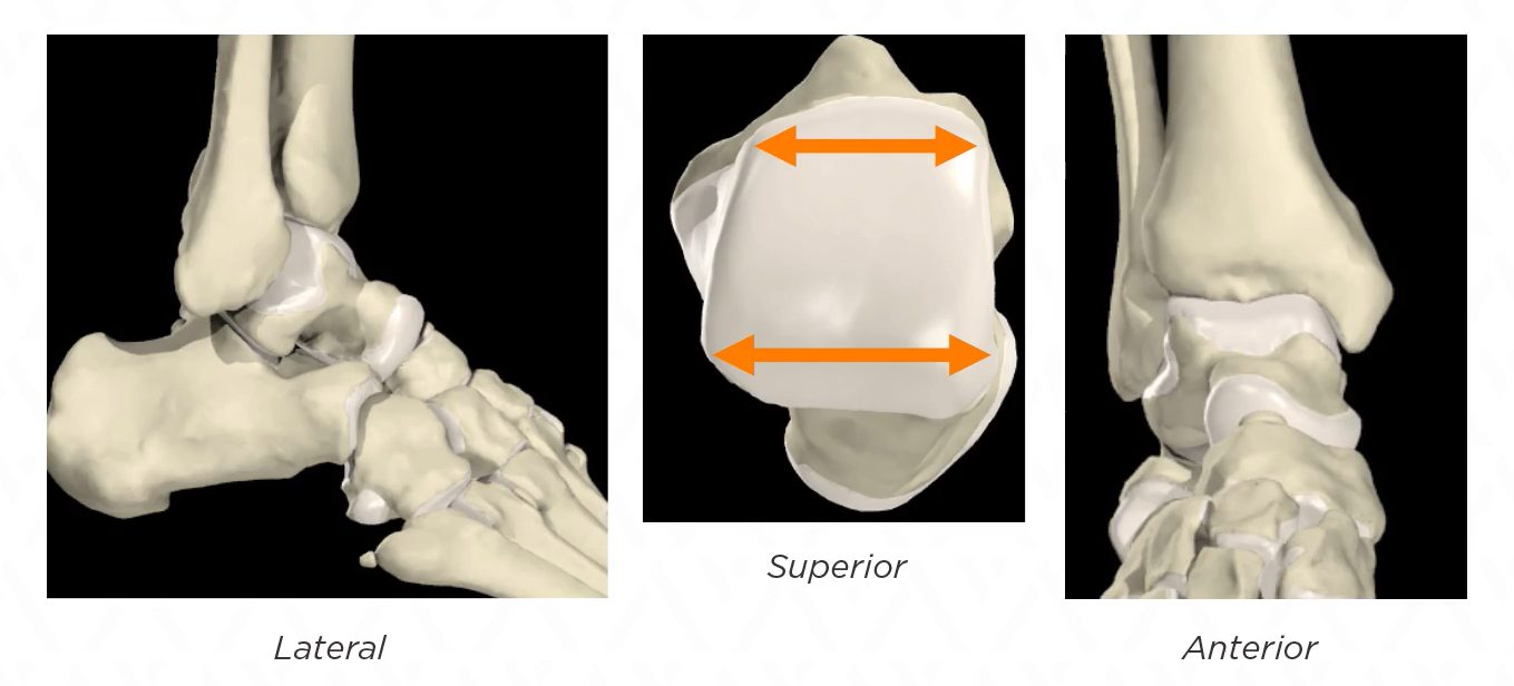 manipulatie in plaats van immobilisatie bij hallux limitus/stijve grote ...